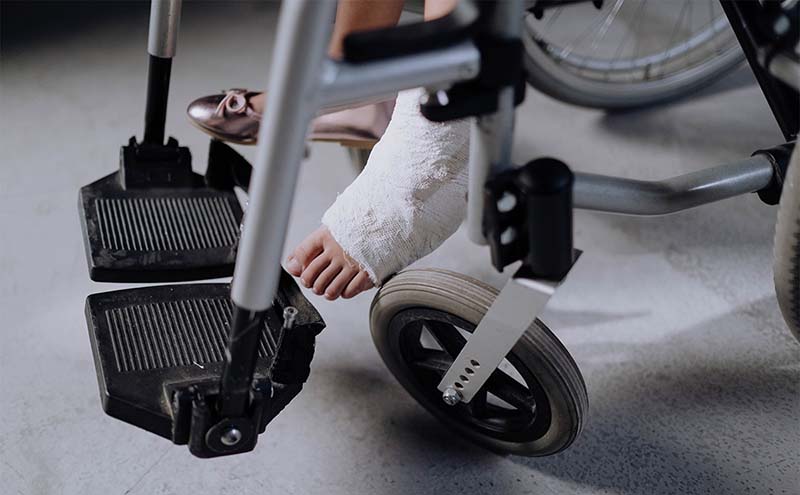 Can you fly with a broken leg? Airline rules